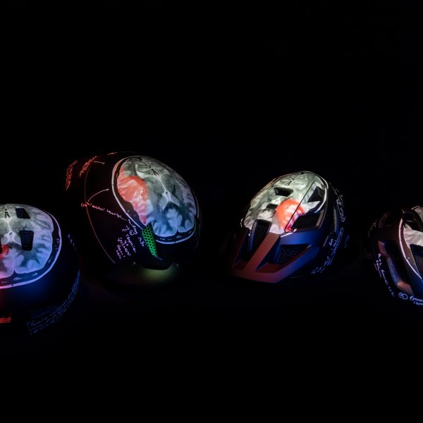 Brain Awareness Week Endura Creates Helmets Designed Using Real-Life ...