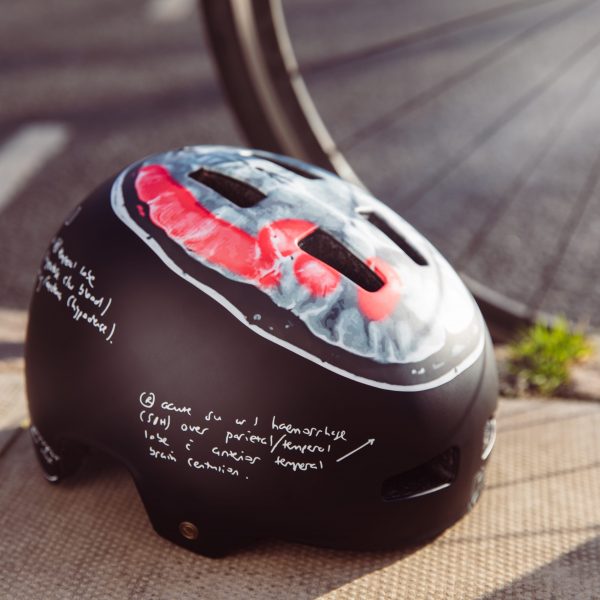 Brain Awareness Week Endura Creates Helmets Designed Using Real-Life ...